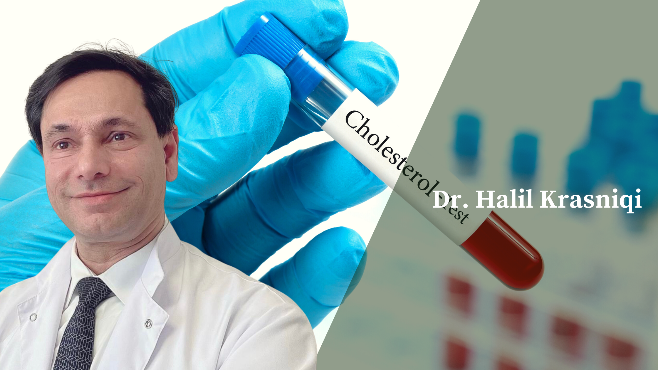 Yndyrat apo Lipidet në gjak (kolesteroli, HDL dhe LDL) - Familjajone